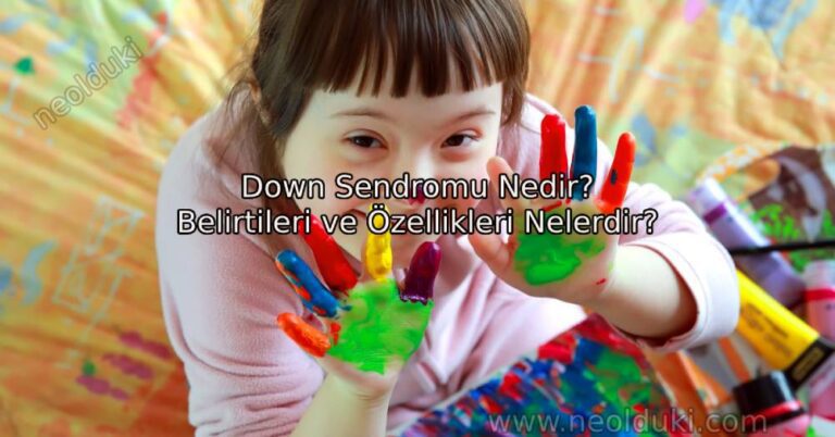 Down Sendromu Nedir? Belirtileri ve Özellikleri Nelerdir?